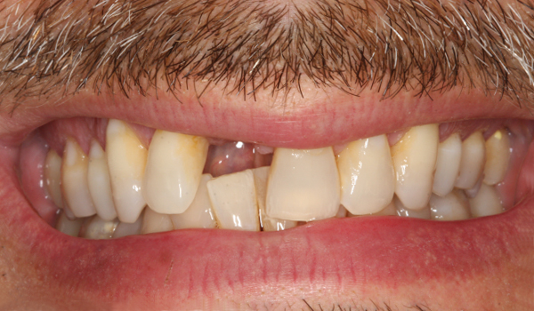 Smile Gallery | Briglia Dental Group - West Chester PA